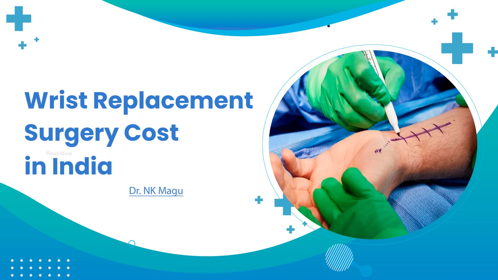 Wrist Replacement Surgery Cost in India | Dr. NK Magu